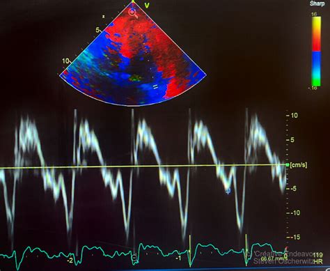Echo Map And Waveforms By Creative Endeavors Steven Oscherwitz Wall Art