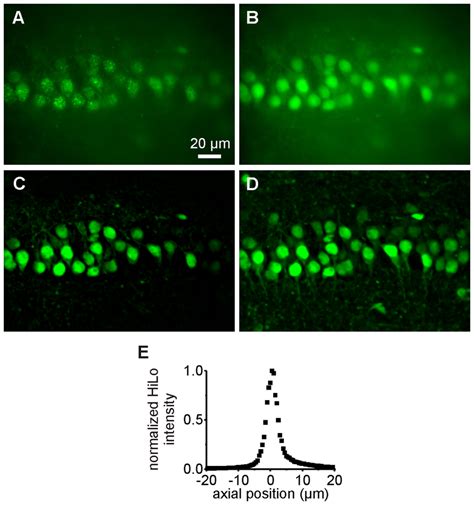 Optical Sectioning With Hilo Microscopy Ac Speckle A And Uniform Download Scientific