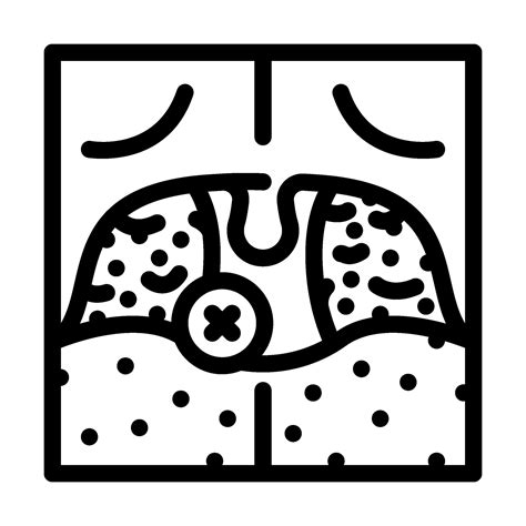 Tonsillectomy Surgery Line Icon Illustration 49843044 Vector Art At Vecteezy