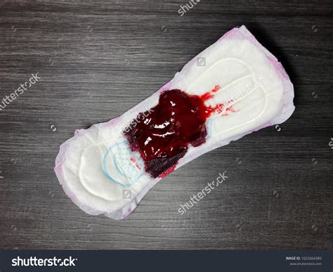 Female Period Blood Clots