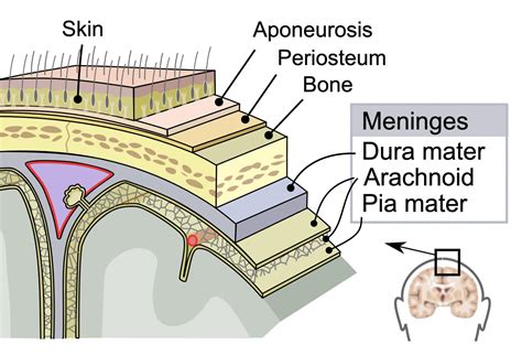 Meningitis Infectious Diseases Geeky Medics