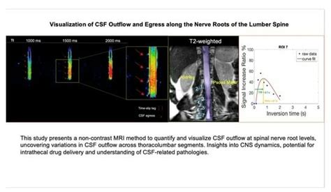 Visualization Of Cerebrospinal Fluid Outflow And Egress Along The Nerve