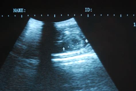 Breeding Python Regius World Of Ball Pythons