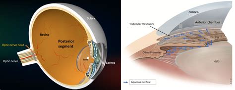 What Does Primary Open Angle Glaucoma Look Like At Tami Lumley Blog