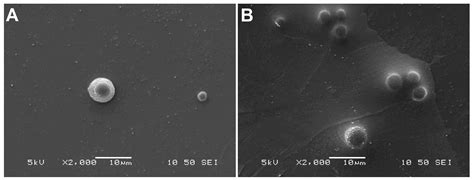 Design Of Pectin Based Hydrogel Microspheres For Targeted Pulmonary