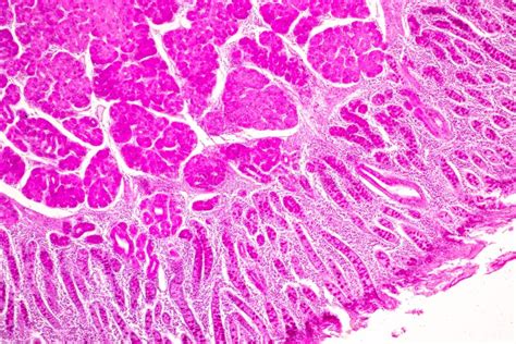 Small Intestine Duodenum And Vermiform Appendix Human Under The Microscope Stock Image Image