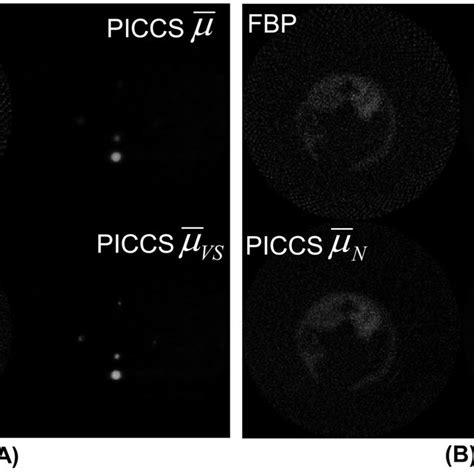 Comparison Of Images Reconstructed With The Fbp Algorithm And The Piccs Download Scientific