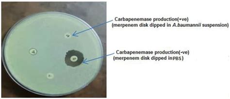 Acinetobacter On Blood Agar