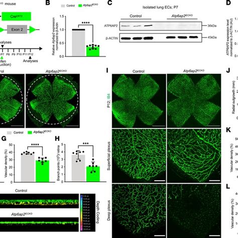 defective retinal angiogenesis in ec specific atp6ap2 ko mice a