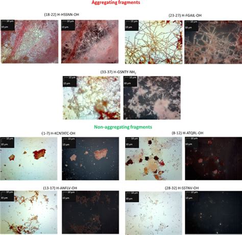 Summary Of The Results Of Microscopic Examination Of Amylin Fragments Download Scientific
