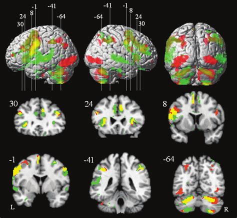 brain activation as a function of modality and working memory load red