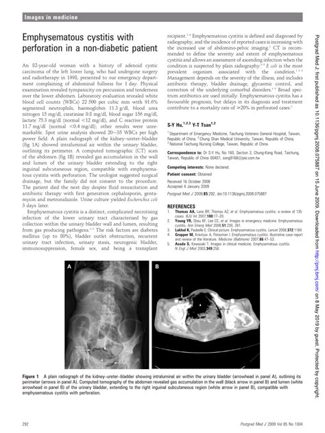 Pdf Emphysematous Cystitis With Perforation In A Non Diabetic Patient