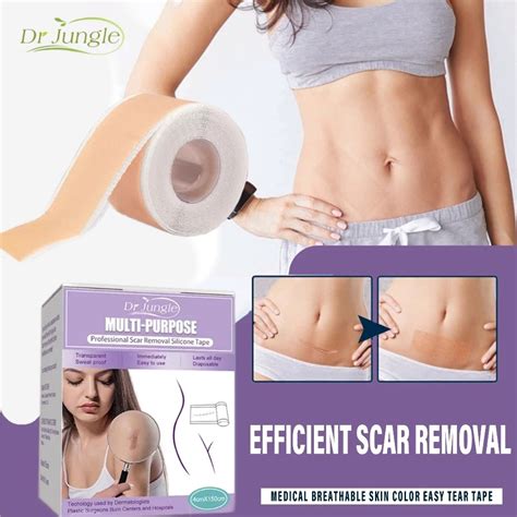 Scar Patch Caesarean Section Acne Scars Burn Scar Removal Silicone