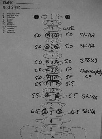 Growth Guided Instrumentation Shilla Procedure Neupsy Key
