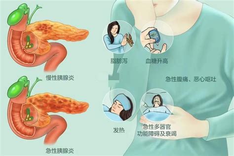 胰腺炎是什么 西安凤城医院 官网 急救电话：029 86530966