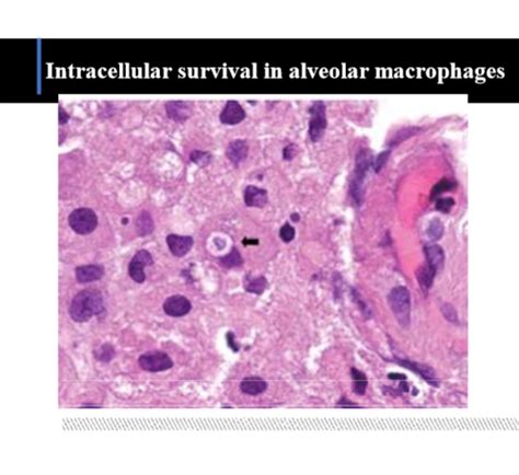 Rhodococcus And Histophilus Flashcards Quizlet