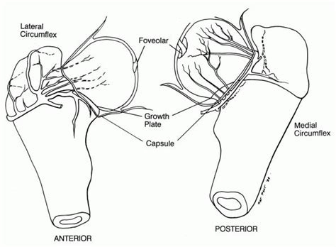 Mcp Metacarpophalangeal Dislocation Teachme Orthopedics Mcp Metacarpophalangeal Dislocation Teachme Orthopedics