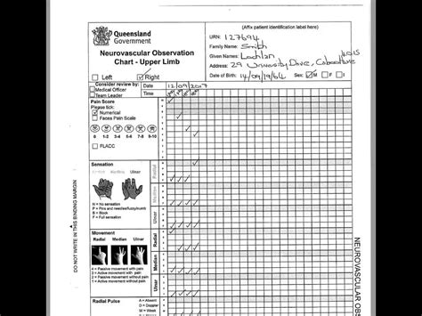 Neurovascular Points Chart At Gail Ervin Blog