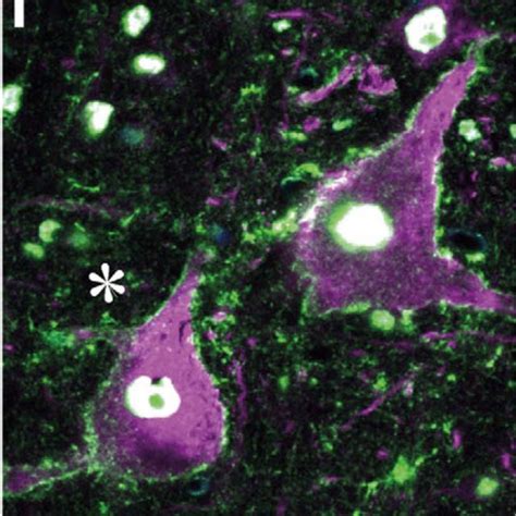 Kv31b Expression In The Membranes Of Macaque M1 Pyramidal Neurons A Download Scientific