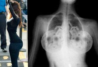 Are Your Full Body Scan Images Private Funny Gallery EBaum S World