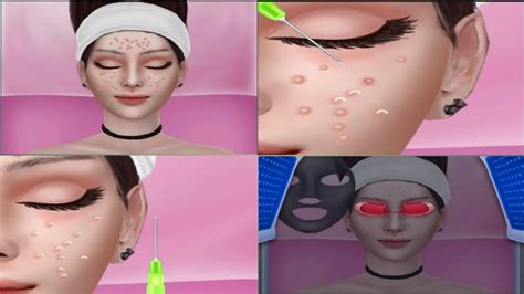 Asmr Acne Removal Youtube