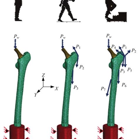 Material Properties Of Cancellous Bone Cortical Bone And Epoxy In Download Scientific Diagram