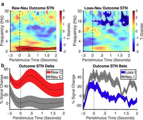 Subthalamic Oscillatory Activity Of Reward And Loss Processing Using The Monetary Incentive