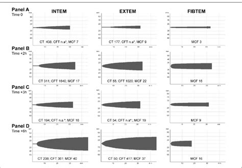 Rotem ® Thromboelastometry Profile During Massive Gastrointestinal