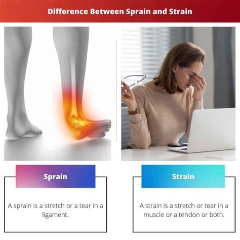 Sprain Vs Strain Difference And Comparison