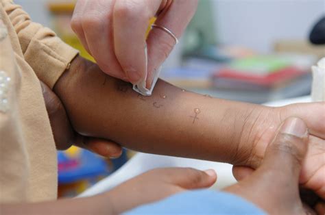 Does Insurance Cover Allergy Tests Ambetter Health