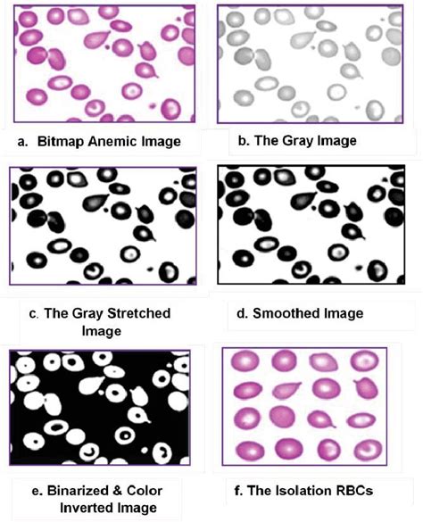 An Illustration Of Rbcs Process 3 Localization And Segmentation These