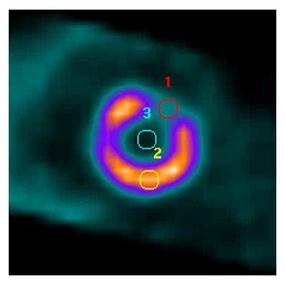 Example Of ROI Positions That Were Used For Contrast Analyses ROI Download Scientific Diagram