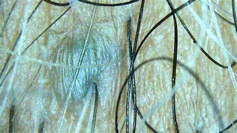 Scalp Analysis Unique Hair Experience