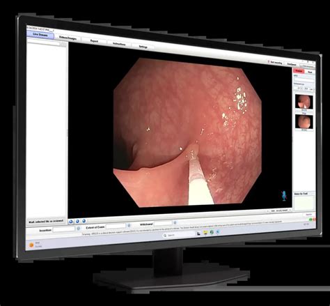 Ai Procedure Documentation Natural Language Processing Nlp Argus®