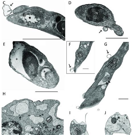 Ultrastructural Analysis Transmission Electron Microscopy Tem Of Download Scientific Diagram