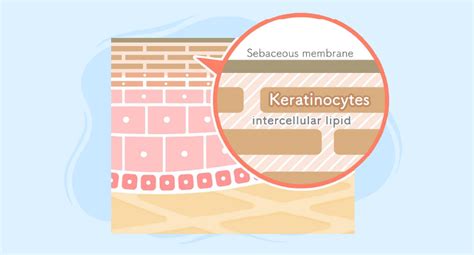 Rethinking Skin Health Insights Into Hyperkeratosis Medtigo Courses