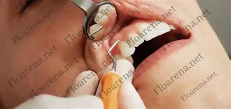 Understanding The Difference Between Plaque And Tartar In Dental Health