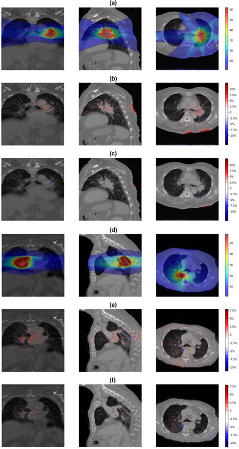 A The Ground‐truth” Acuros Xb Axb Dose Maps And Relative