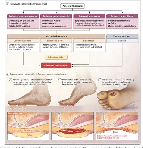 Figure 1 From Improving The Healing Of Diabetic Foot Ulcers A Real