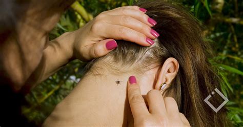 რატომ არის საშიში ტკიპის ნაკბენი და როგორ დავიცვათ თავი პარაზიტებისაგან