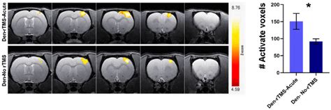 Fmri Bold Responses To Intact Forepaw Stimulation Eight Weeks After
