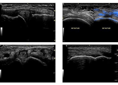 Logiq R8 Ultrasound General Electric Portable Ultrasound Herbitas®
