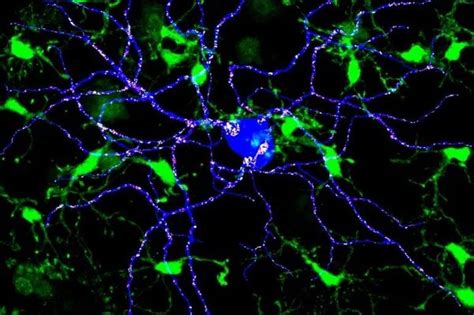 Drug That Targets Tauopathies In Mice Reveals Sex Differences In Response Neuroscience News