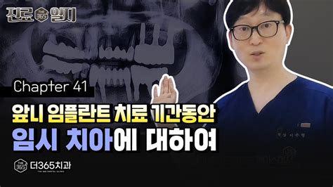 앞니 임플란트 치료 기간동안 임시치아에 대하여 【더365치과】 진료일지 41 Youtube