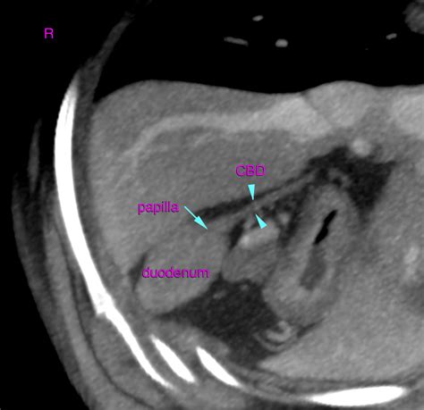 Ct Structurally Normal Abdomen In A 10 Year Old Mn Dachshund With