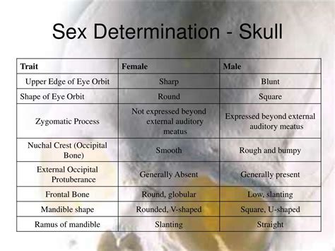 PPT Why Study Bones PowerPoint Presentation Free Download ID 440888