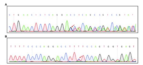 Chip Capture High Throughput Sequencing Result In The Patient A