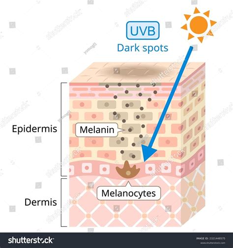Uvb Radiation Penetrate Into Skin Stock Vector Royalty Free 2321448575 Shutterstock