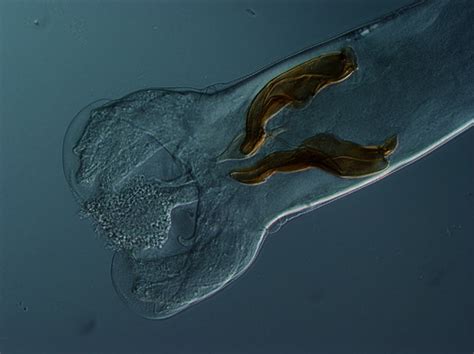 Bursa Copulatrix In Male Of Trichostrongylus Sp Download Scientific Diagram