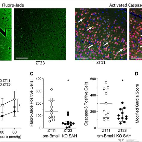 Axial Non Contrasted Ct Of The Brain Showing Subarachnoid Hemorrhage In Download Scientific